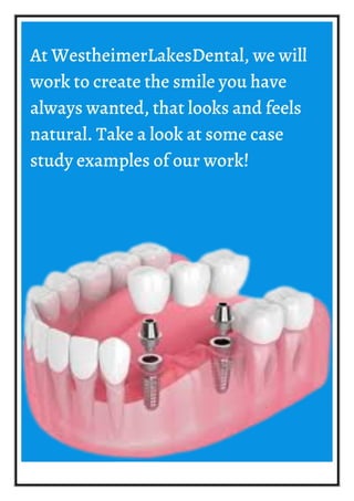 Richmond Dental Crowns & Bridges by Westheimerlakesdental.pdf