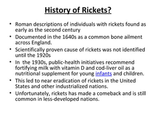 Rickets | PPT