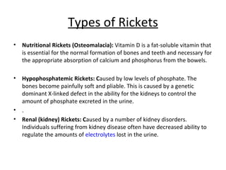 Rickets | PPT