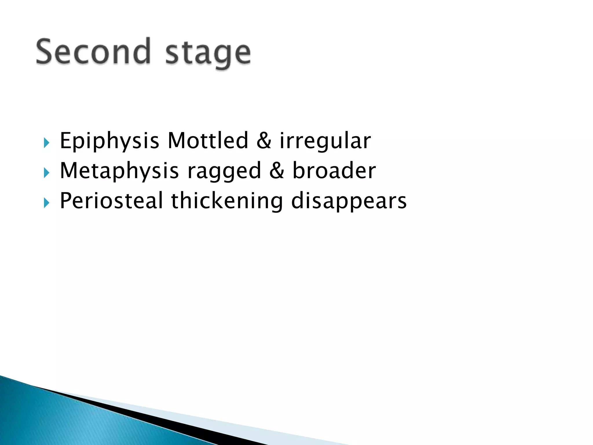Rickets | PPTX