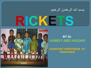 Rickets lecture | PPTX