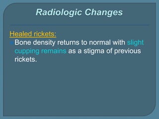 Rickets lecture | PPTX
