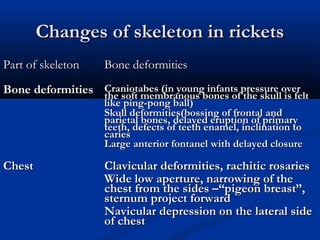 Rickets Hypervitaminosis spasmophilia | PPT