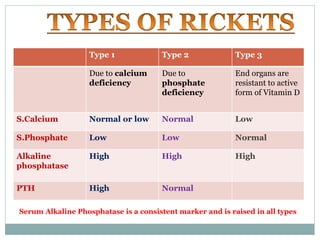 Rickets | PPTX