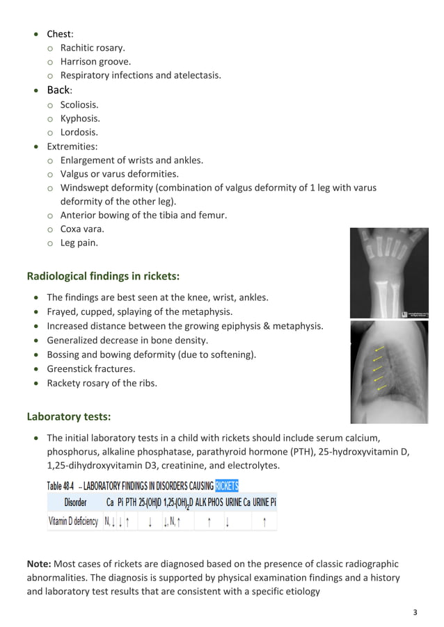 Rickets | PDF