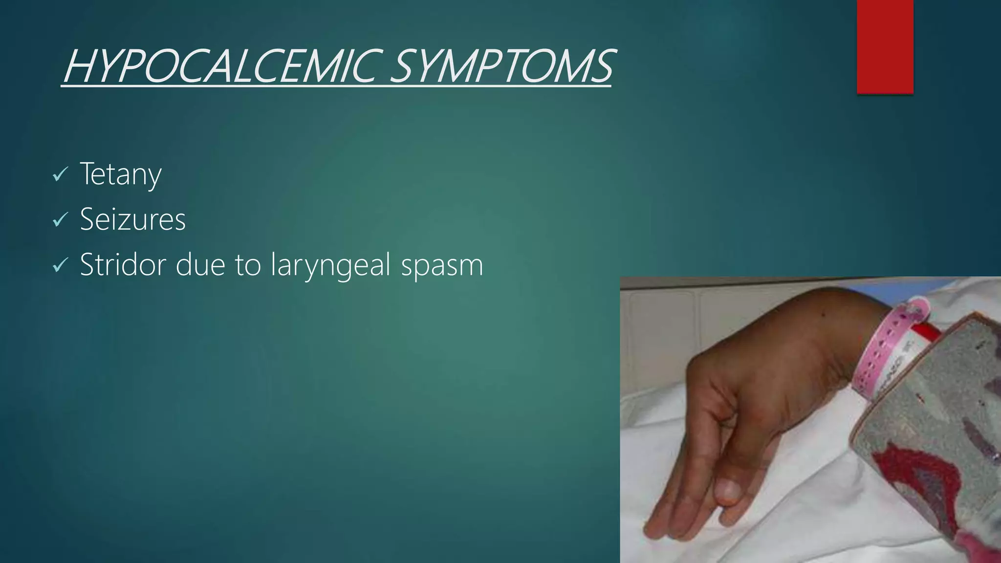 Rickets | PPTX | Bone and Joint Conditions | Diseases and Conditions