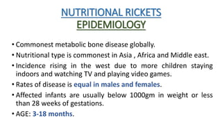 Rickets | PPTX