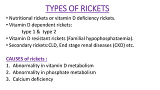 Rickets | PPTX