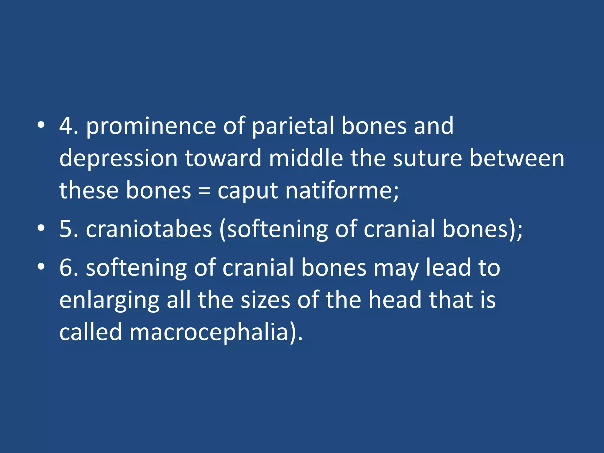 Rickets | PPTX