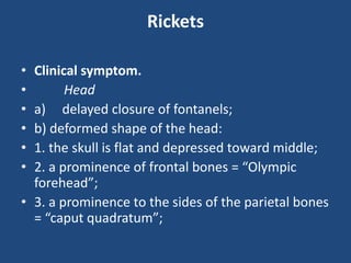Rickets | PPT