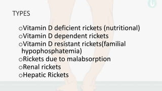 Rickets | PPTX