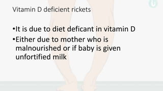 Rickets | PPTX