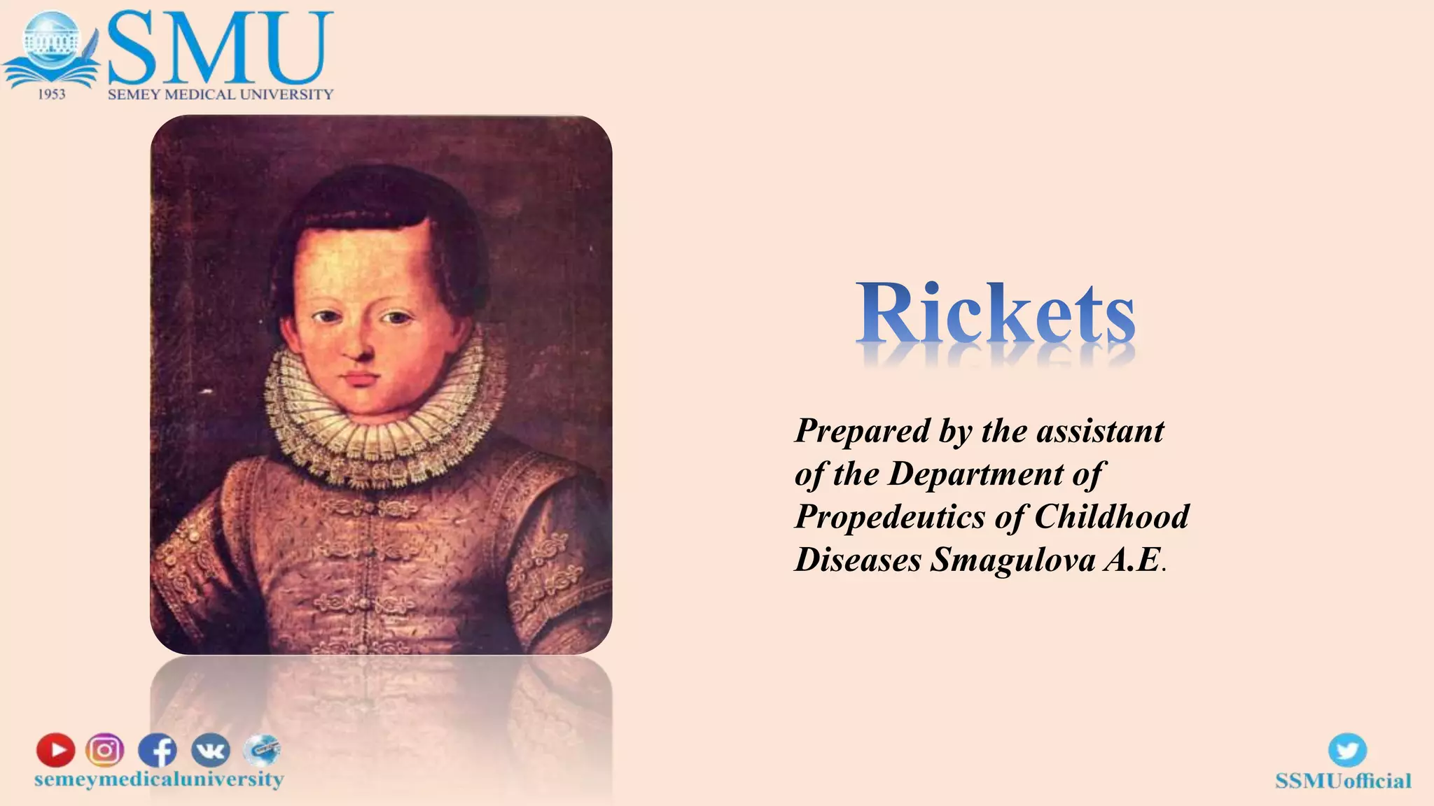 Rickets.pptx