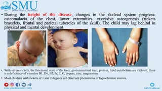 Rickets.pptx