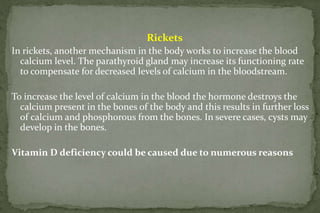 RICKETS .ppt