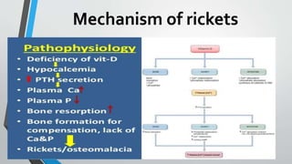 various types of rickets in pediatrics and its diagnosis and treatment.pptx