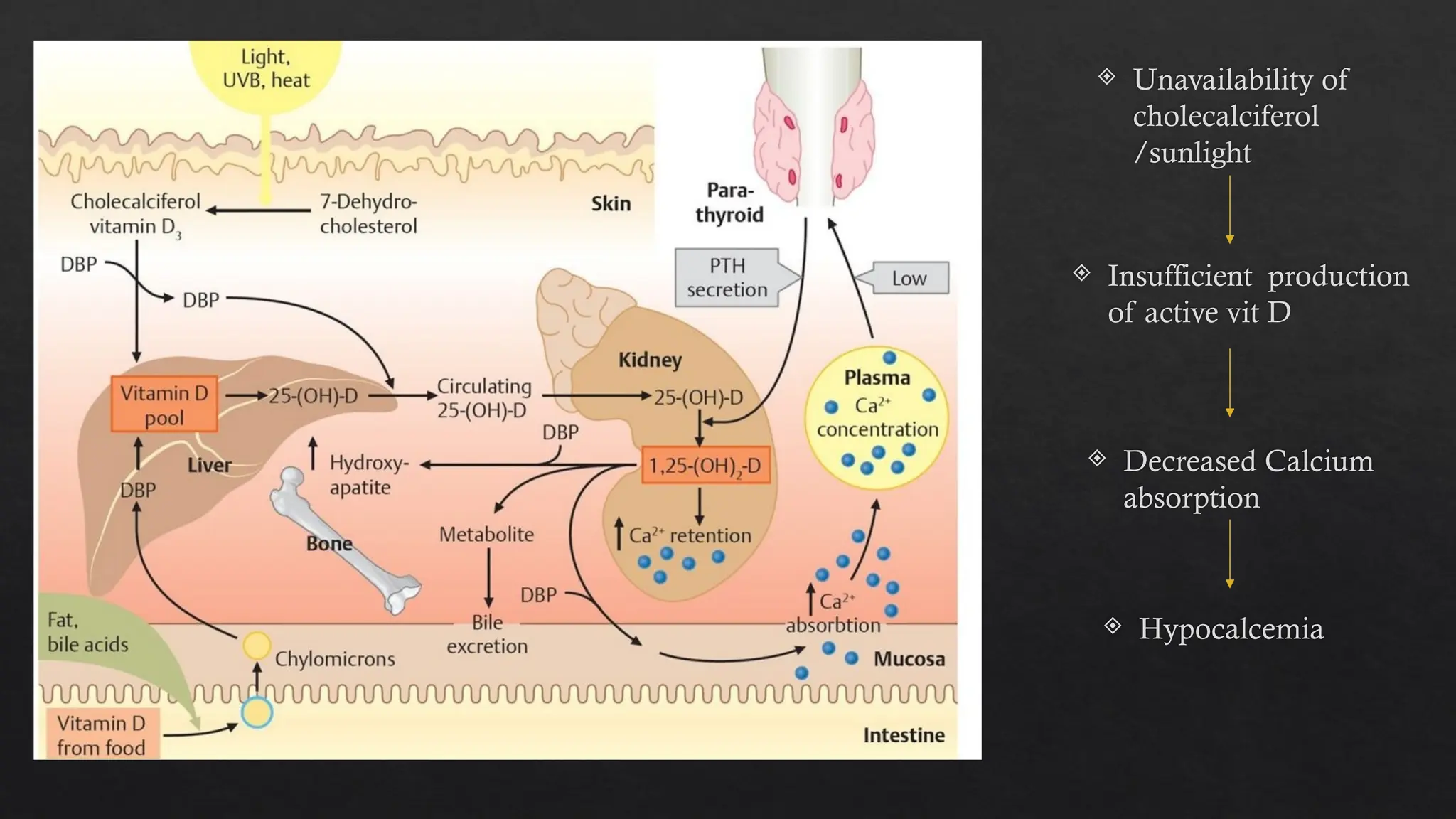 RICKETS - Clinical features, radiological features, classification ...