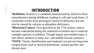 RICKETS AND THE PHYSIOTHERAPY TREATMENT.pptx