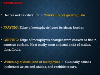 rickets management type prognosis causes | PPTX