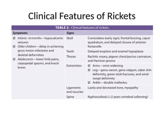 title - Rickets in children and its prevention | PPTX