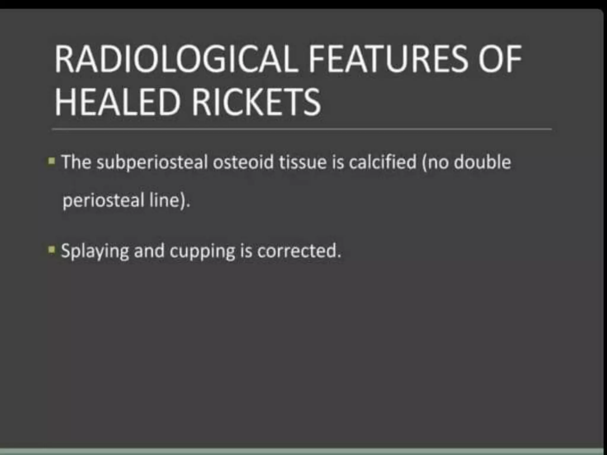 RICKETS -PPT.pptx