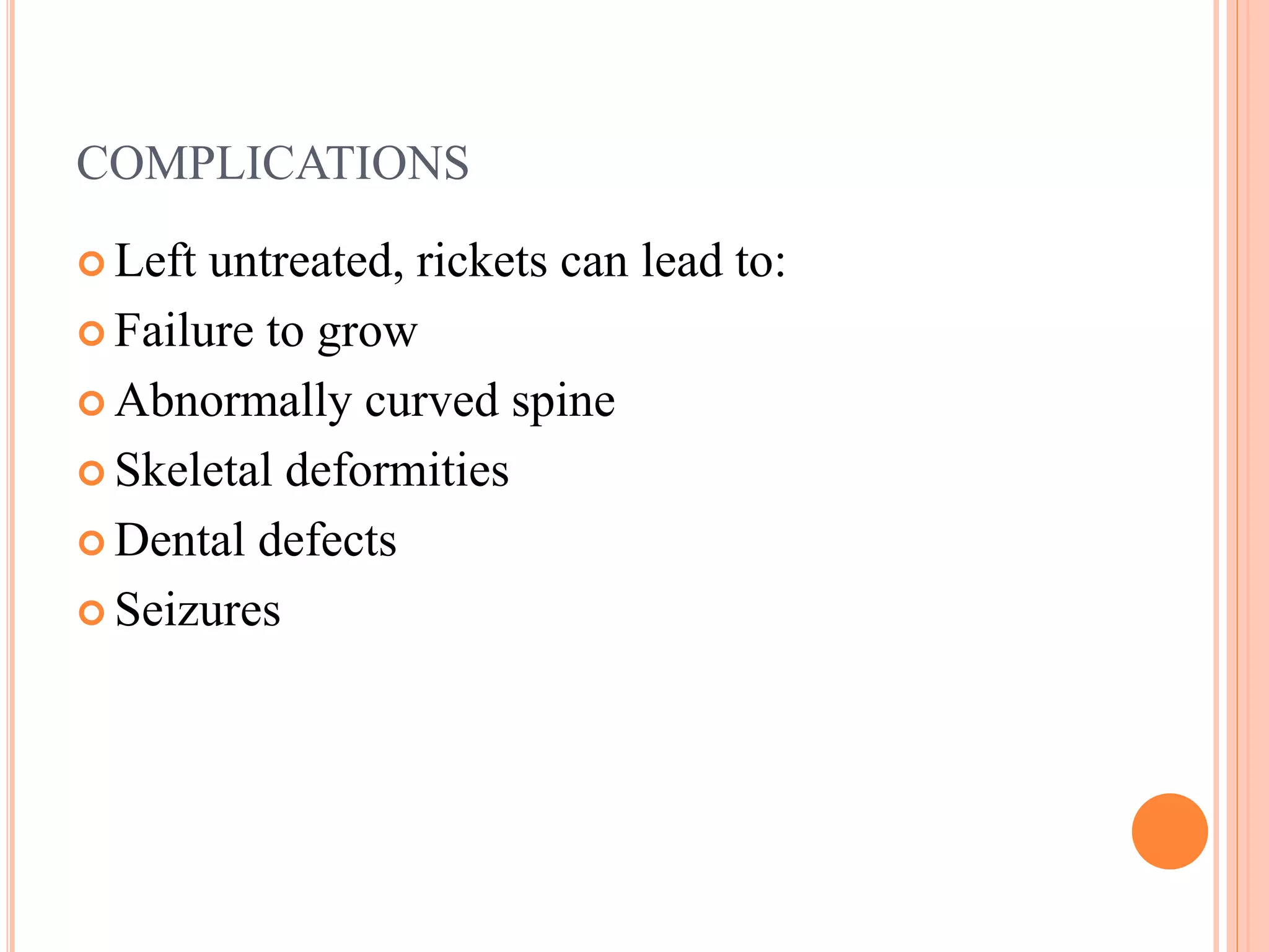 Rickets | PPTX