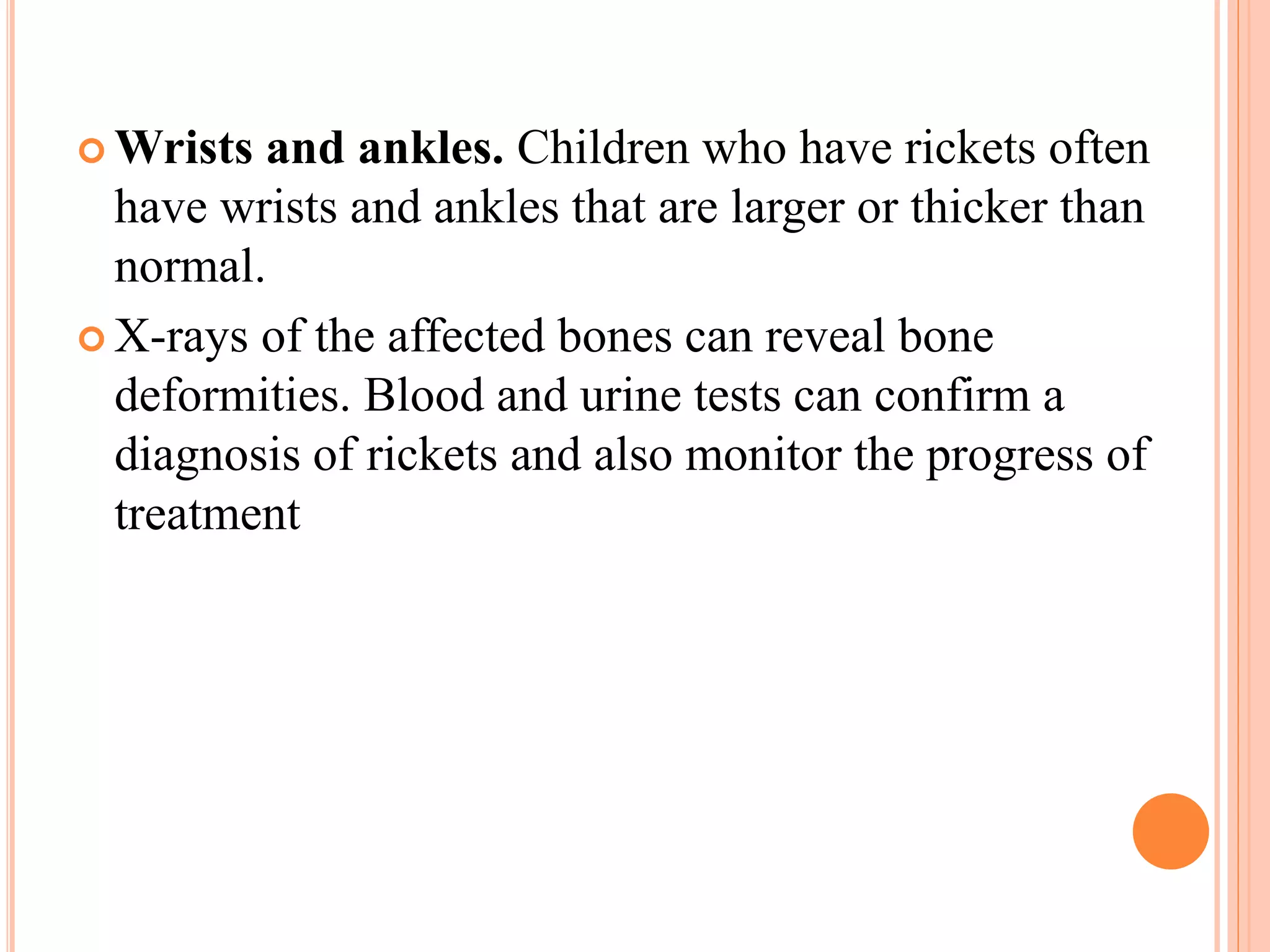 Rickets | PPTX