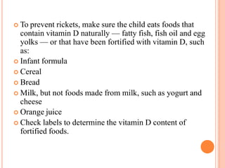 Rickets basics , pathology, diagnosis and management | PPTX