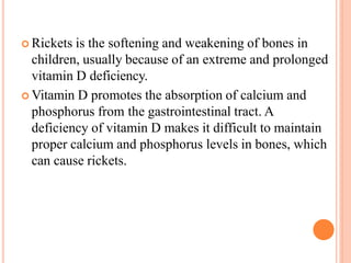 Rickets basics , pathology, diagnosis and management | PPTX