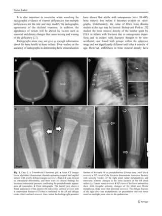 Rickets abuse kathykeller | PDF