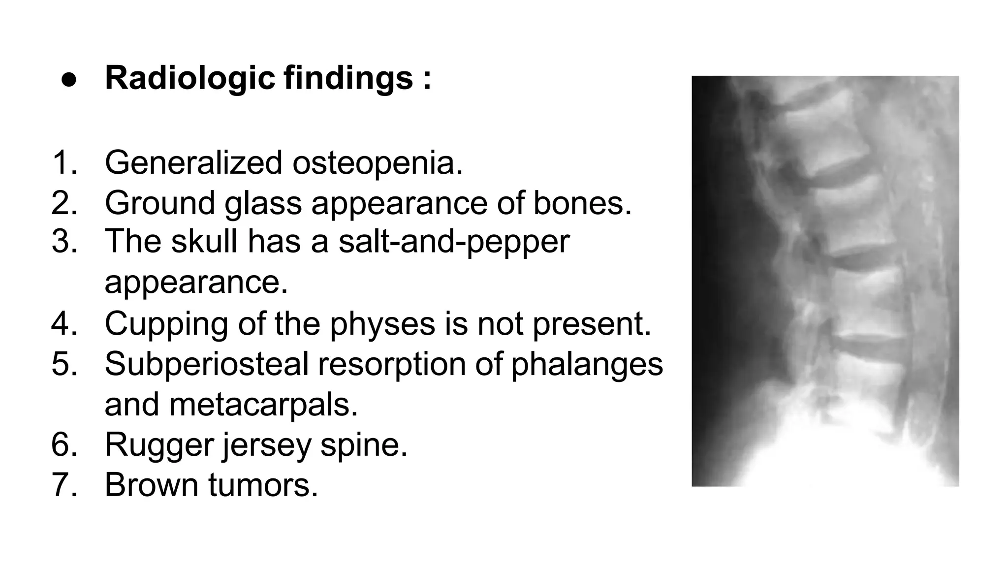 Rickets and osteomalacia presentation for postgarduate in orthopaedics ...