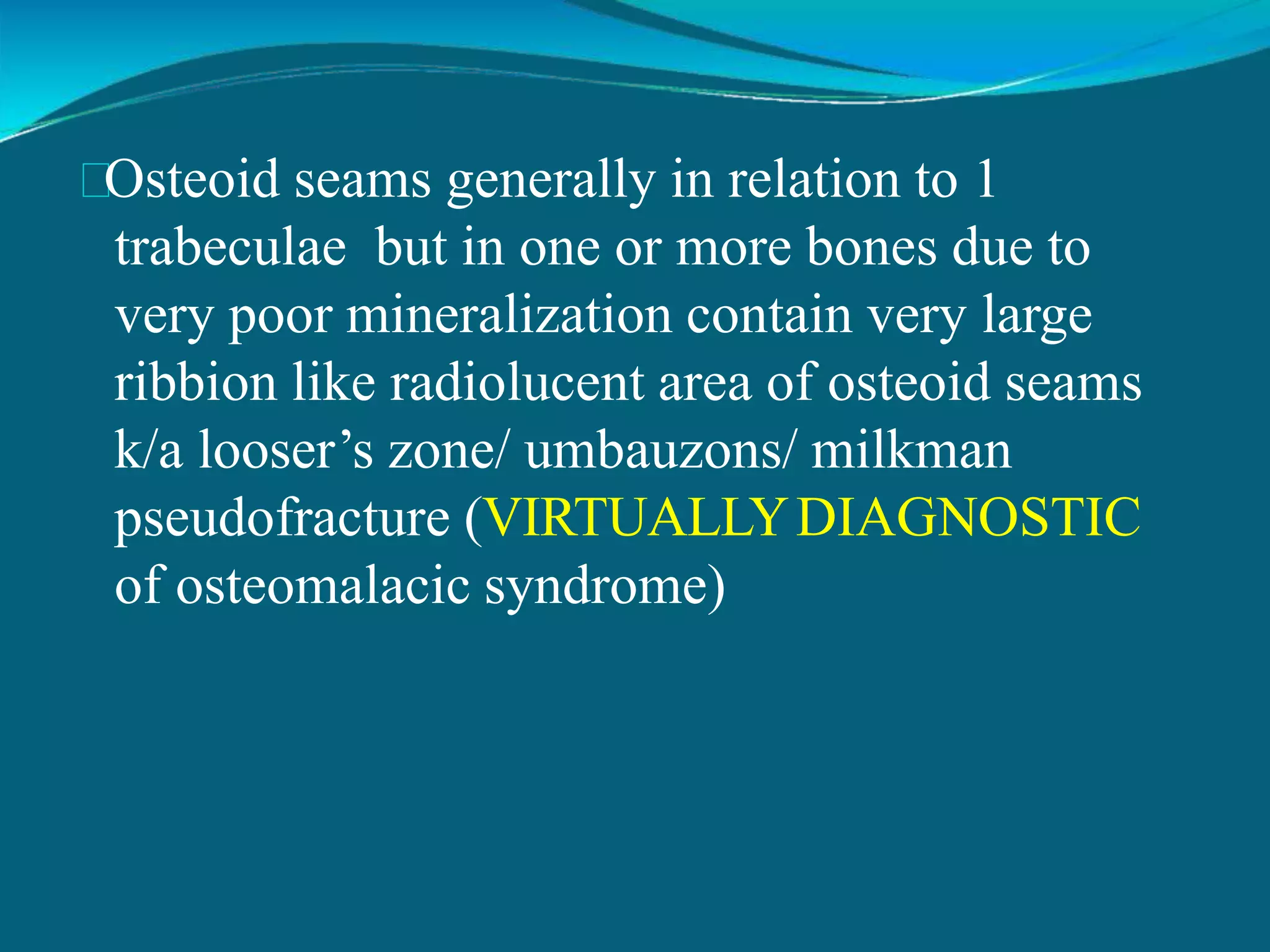 Rickets and osteomalacia | PPTX