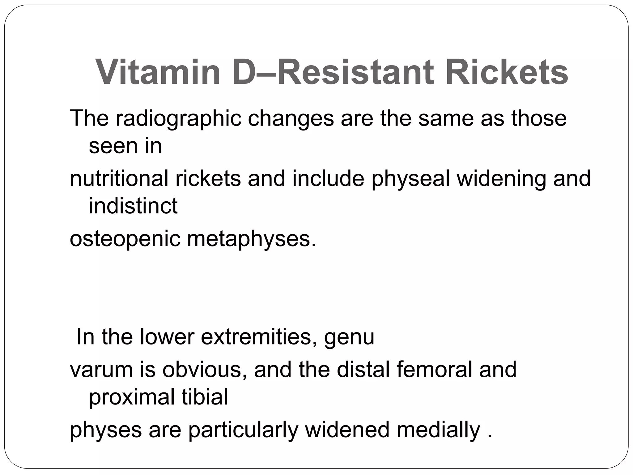 Rickets and osteomalacia | PPT