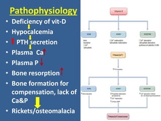 Rickets and osteomalacia,ppt | PPTX
