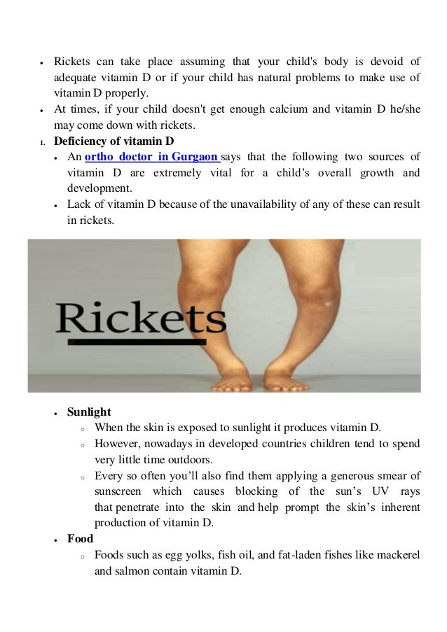 Rickets familiarize yourself with its symptoms and causes