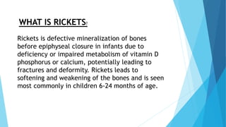 Rickets G1 saman and mina nephrology.pptx