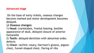 Rickets G1 saman and mina nephrology.pptx