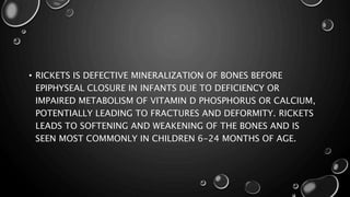 Rickets in children | PPTX