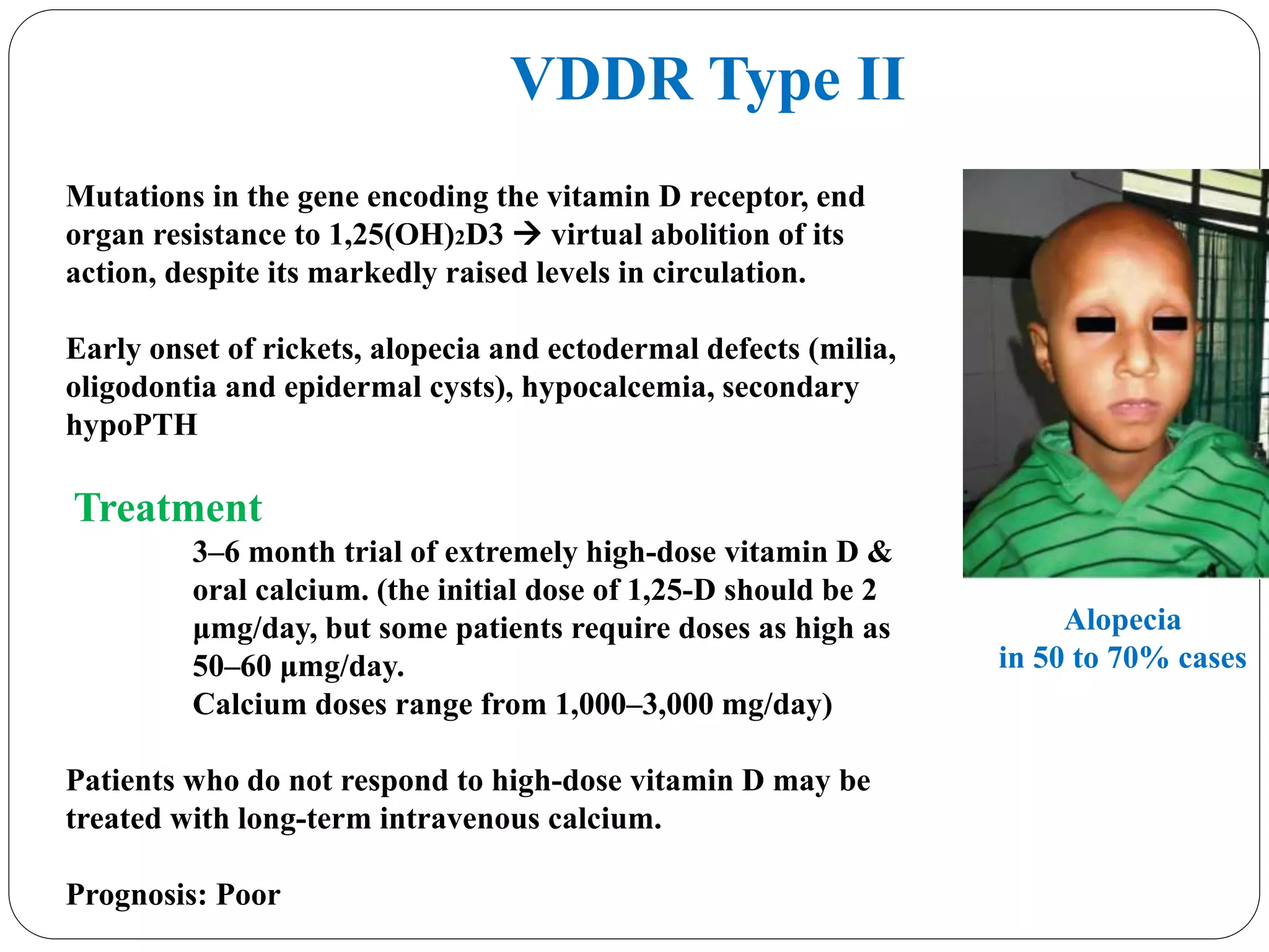 Rickets & osteomalacia | PPTX