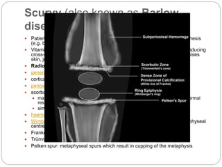 Rickets & osteomalacia | PPTX
