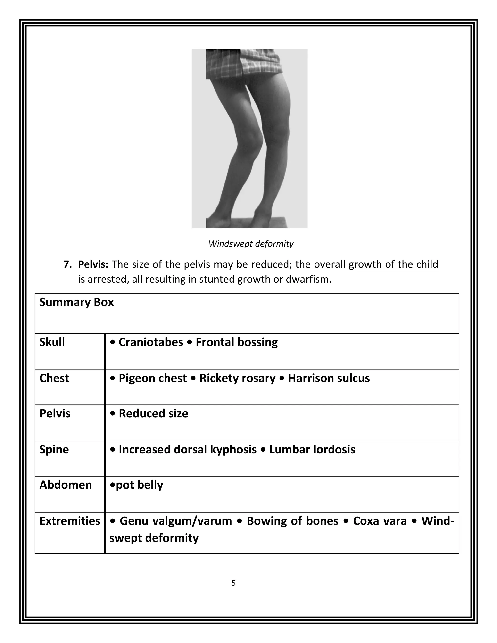 Rickets Rehabilitation program | PDF