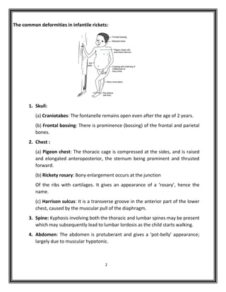 Rickets Rehabilitation program | PDF