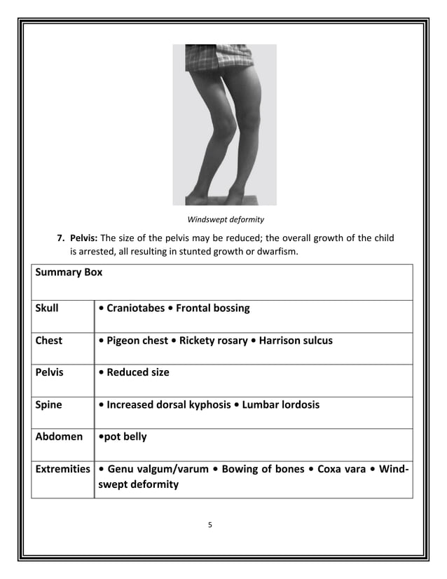 Rickets Rehabilitation program | PDF | Bone and Joint Conditions ...