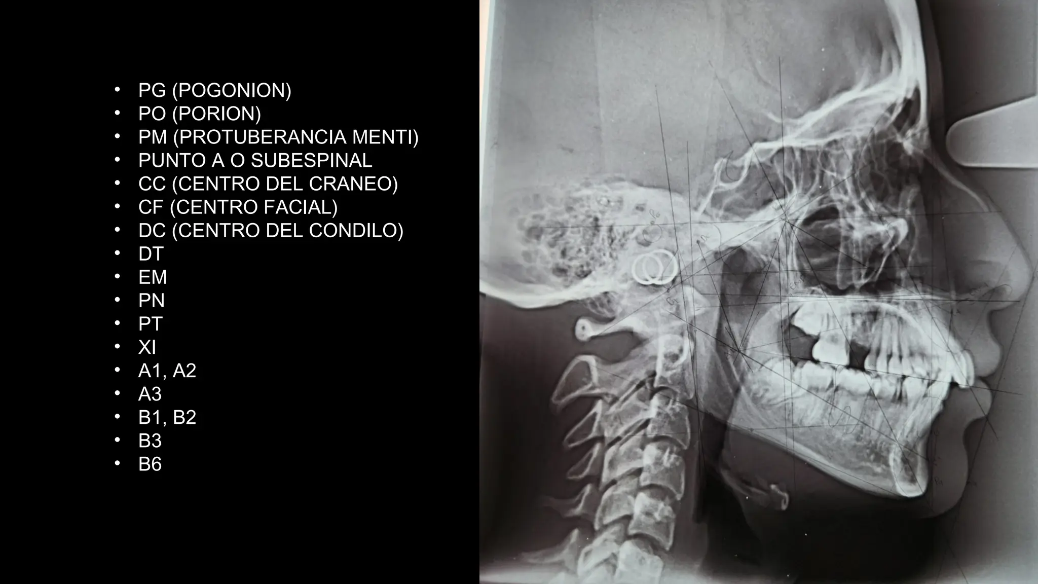 Analisis de Cefalometría de RICKETTS y ricketts simplificado | PPTX