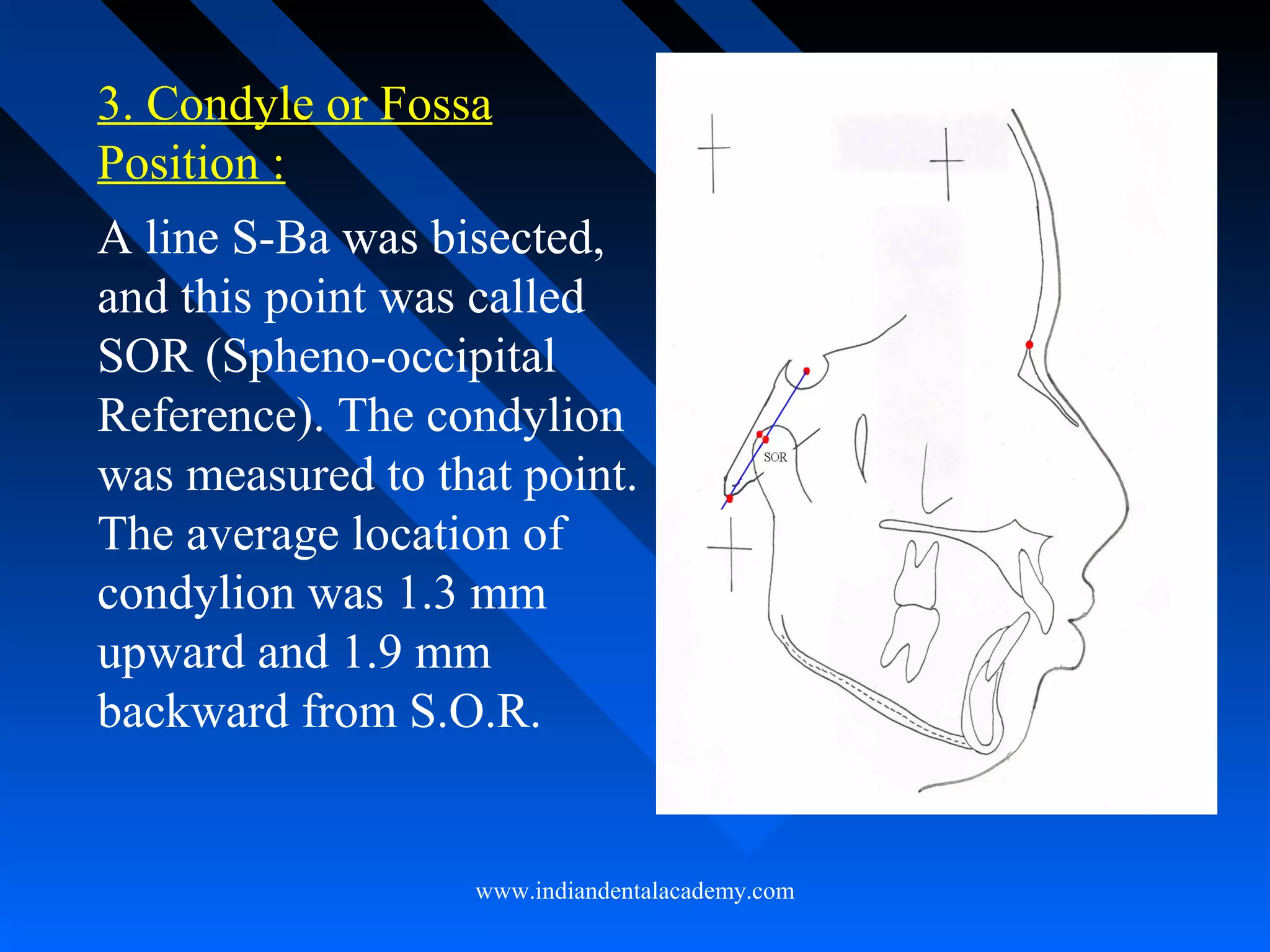 Ricketts analysis /certified fixed orthodontic courses by Indian dental ...