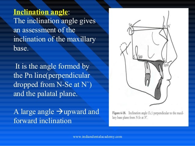 Ricketts analysis /certified fixed orthodontic courses by Indian dent…