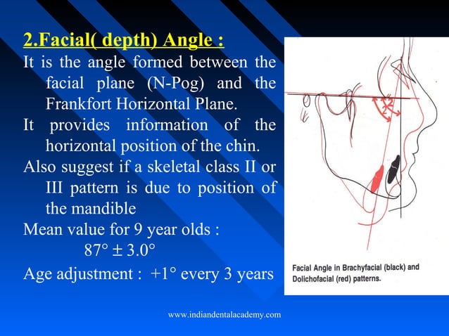 Ricketts analysis in orthodontics /certified fixed orthodontic courses ...