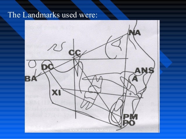 Ricketts analysis in orthodontics /certified fixed orthodontic course…