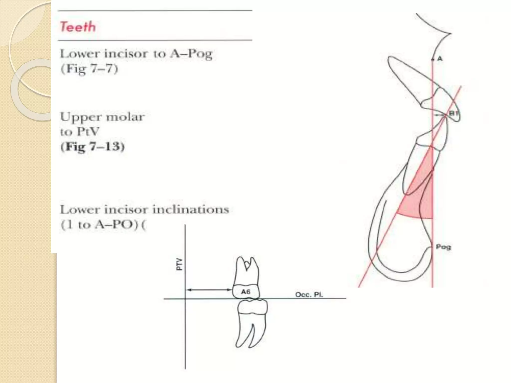 Ricketts analysis | PPTX