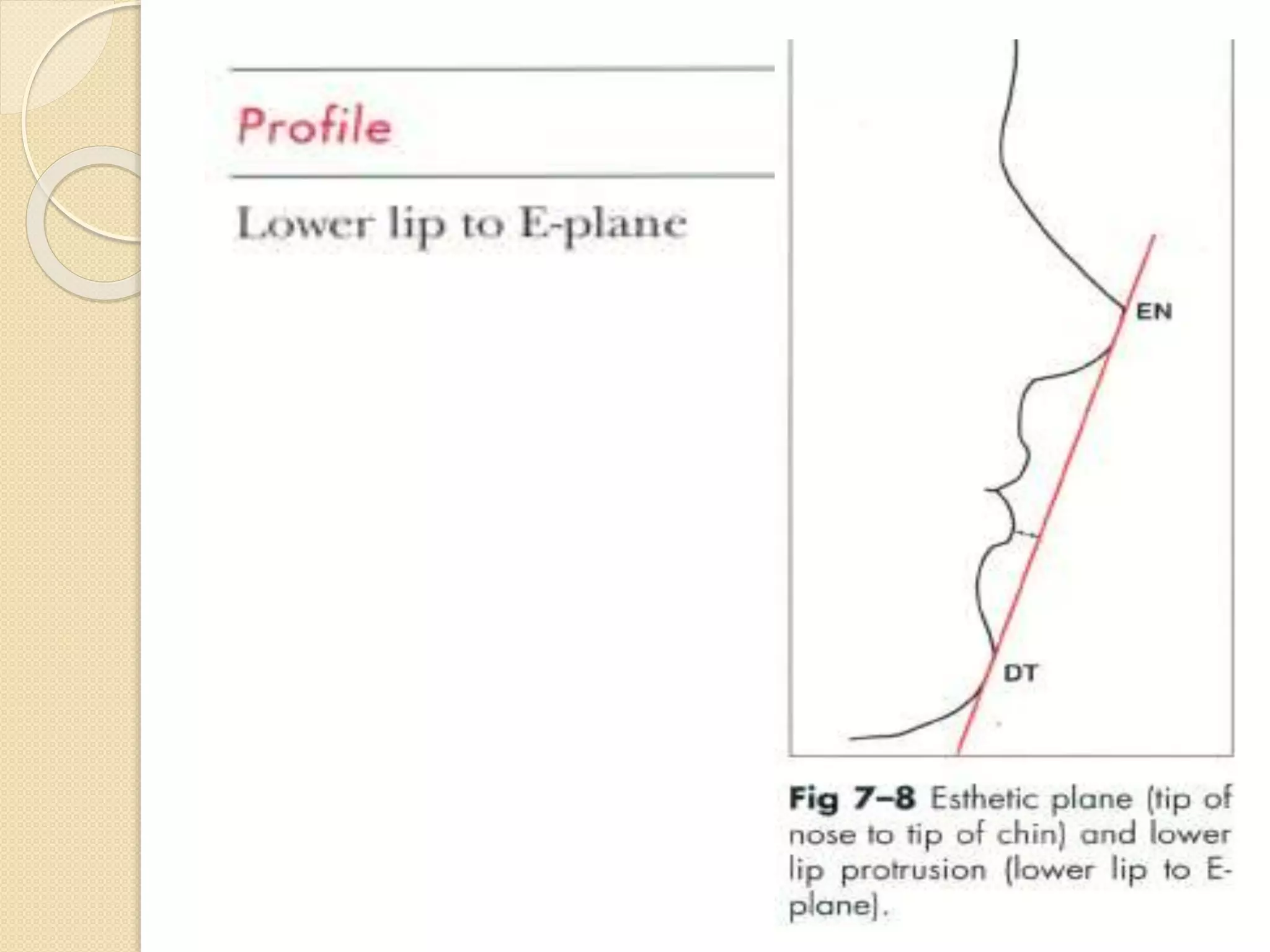 Ricketts analysis | PPTX